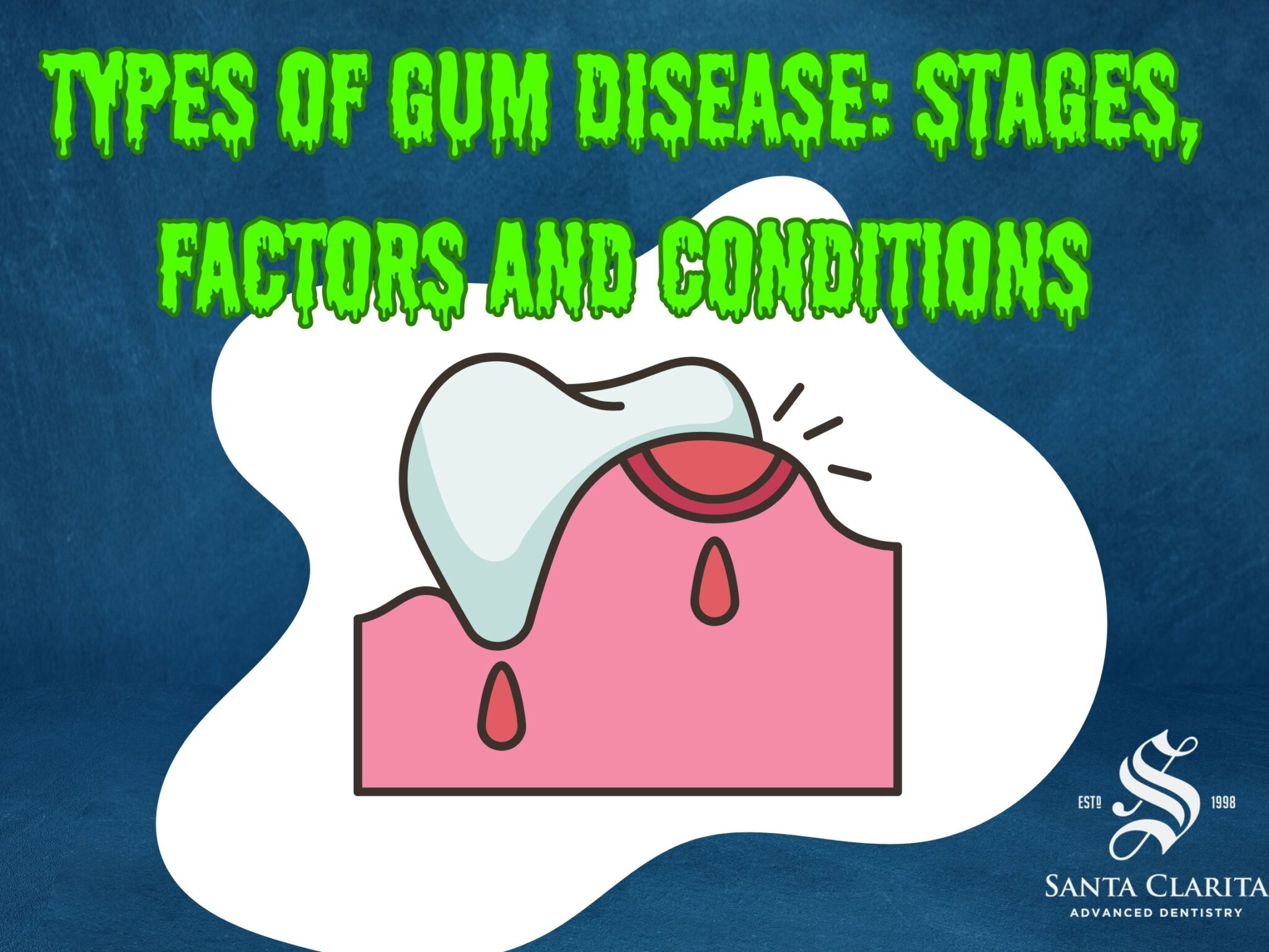 Types Of Gum Disease: Stages, Factors & Conditions
